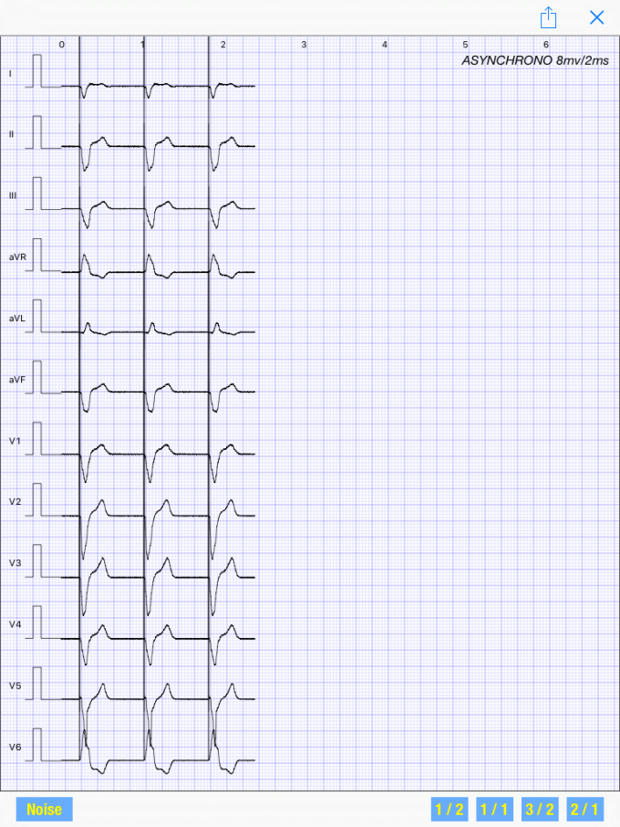 Medical Device Ambulatory ECG Monitoring Portable Simulator Simulate ...