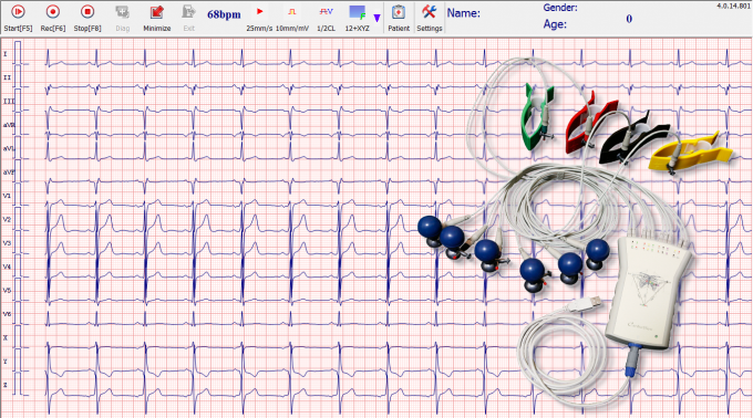 PC Based ECG Support 12-channel Resting Heart Detection with Grey USB ...