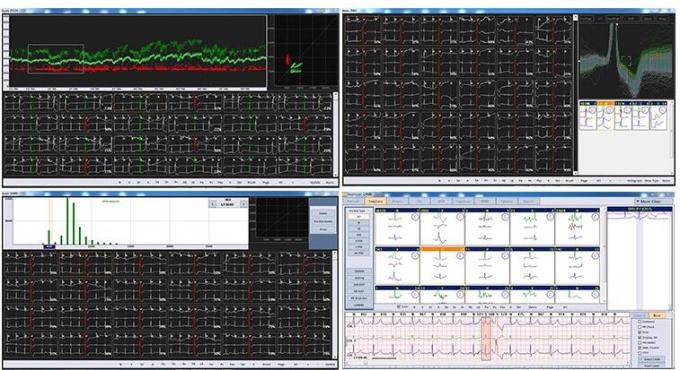 CE / FDA Approved Holter ECG 12 Channel 24-72 Hour Holter White Monitor