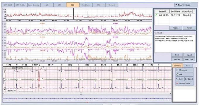 CE / FDA Approved Holter ECG 12 Channel 24-72 Hour Holter White Monitor