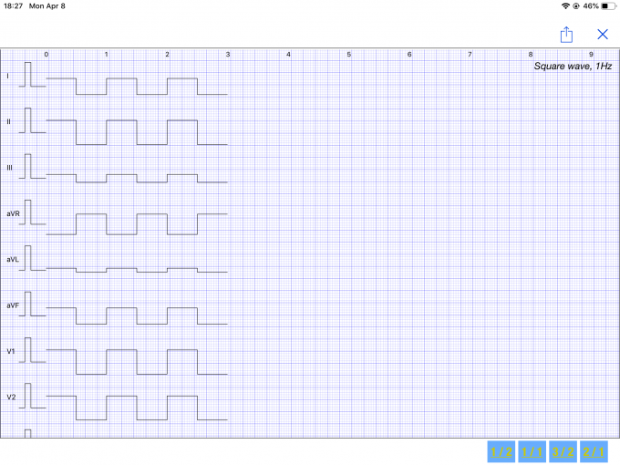 IOS Bluetooth Connection ECG Patient Simulator For Atrial Fibrillation ...